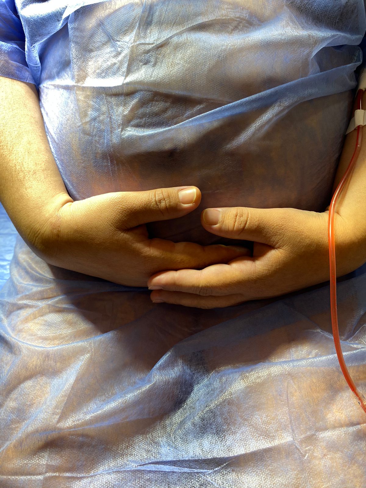 Semana Mundial del Parto Respetado - San Fernando